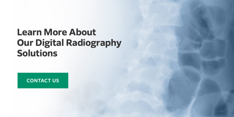 Direct vs Computed Radiography | Complete Guide | Fujifilm