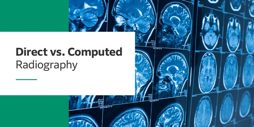 Direct vs Computed Radiography | Complete Guide | Fujifilm
