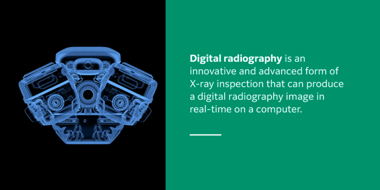 Direct vs Computed Radiography | Complete Guide | Fujifilm