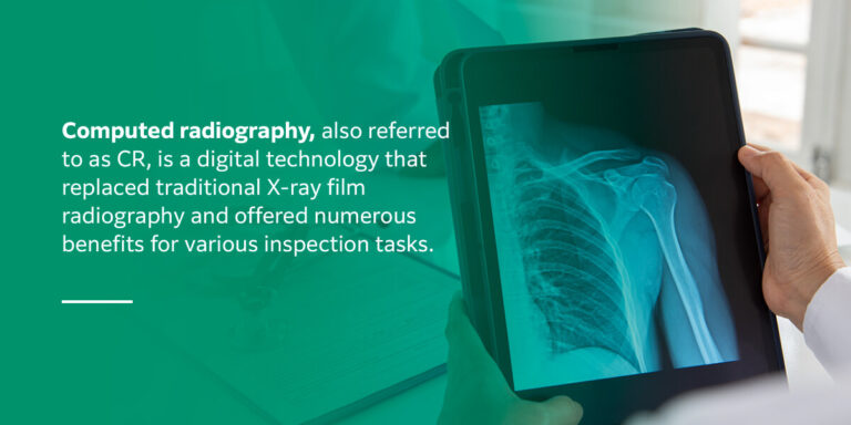 Direct vs Computed Radiography | Complete Guide | Fujifilm