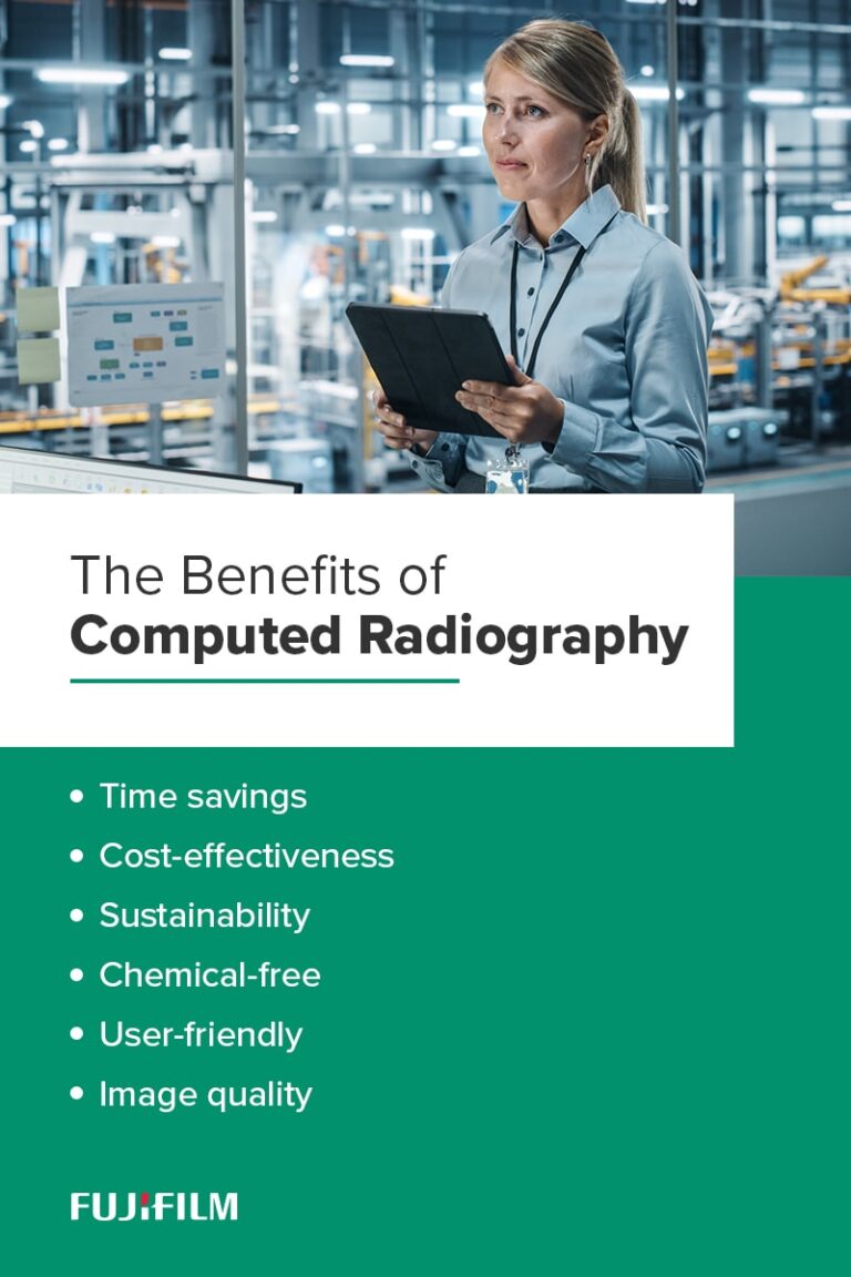 What Is CR Digital Radiography? | Computed Radiography